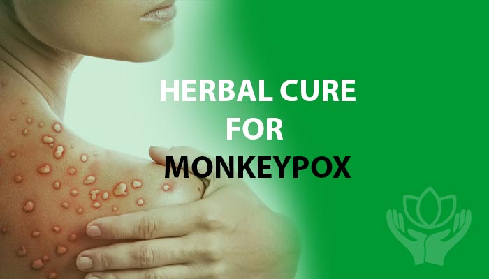 Traditional Medicine for Monkeypox - Healing Plants